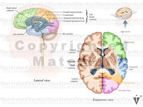 Axial Brain Anatomy