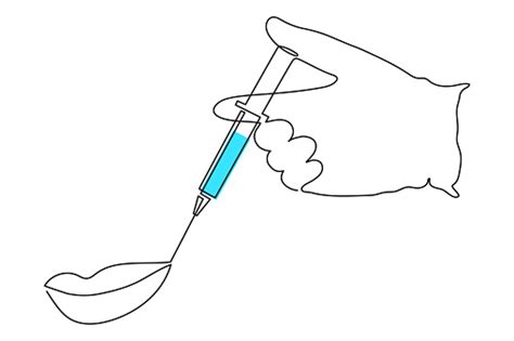 입술에 미용 장갑을 낀 손으로 주사기 한 라인 아트 연속 드로잉 윤곽 입안을 통통하게 만드는 치료 의료 개념 주사 보톡스 복용량 편집 가능한 획 0명에 대한 스톡 벡터 아트