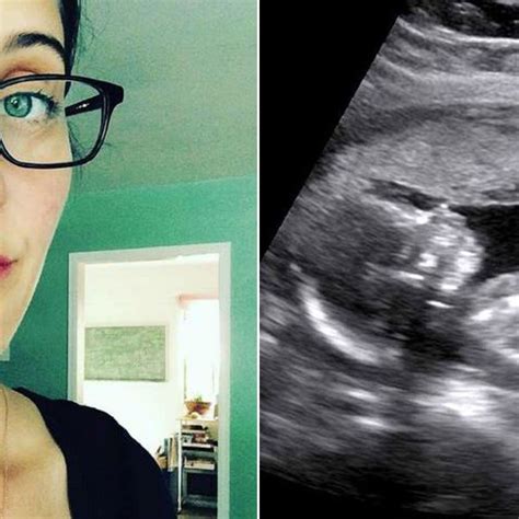 Why This Woman S Fake Ultrasound Photo Went Viral