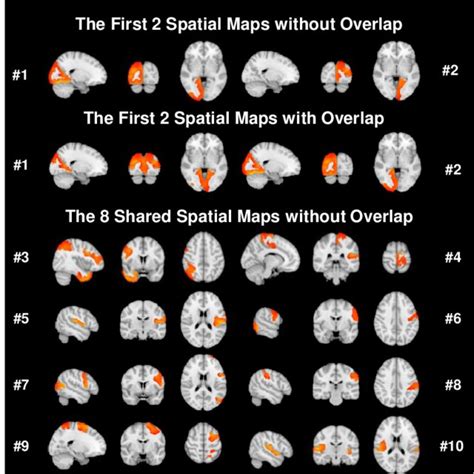 Ten Independent Brain Spatial Maps Used To Simulate Mri Data