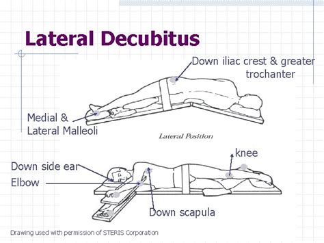 Surgical Patient Positioning Prepared By Cecile Cherry Rn