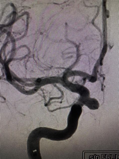 Monica Percolla Posted On Linkedin