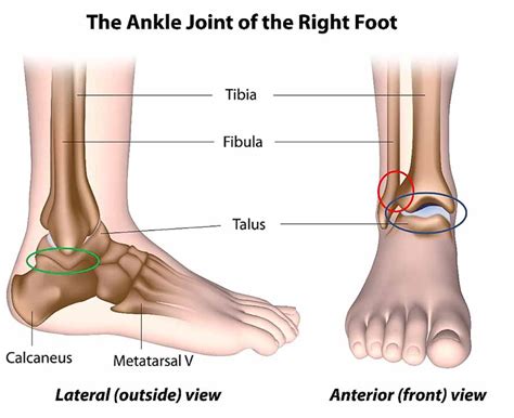 Lateral Ankle Ligament Sprain Ultrasound Guided Injections