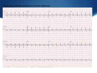 Principles Of Ecg Interpretation Ppt