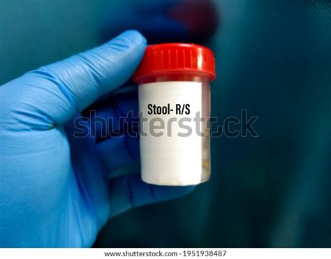 Doctor Hold Stool Sample Container For R S Reducing Substances Test Stool Sample R S Test