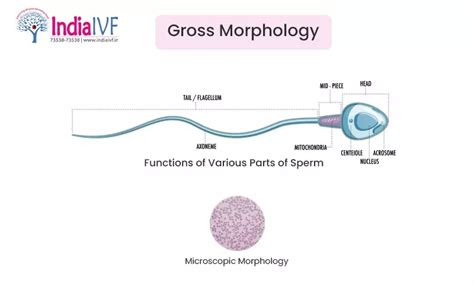 Explore Sperm Morphology Real Pics Size Shape And Function