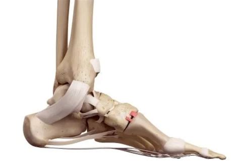 Dont Use 2 CPT Codes When 1 Will Do Orthopedic Coding