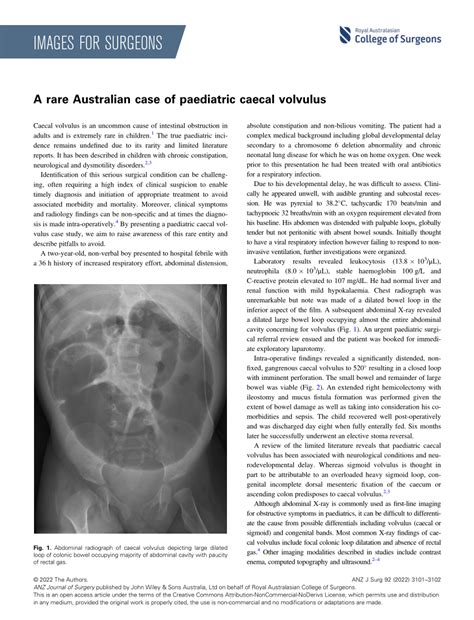 Pdf A Rare Australian Case Of Paediatric Caecal Volvulus