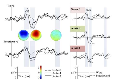 Figure 2 From Perception Of Prosodic Modulations Of Linguistic And