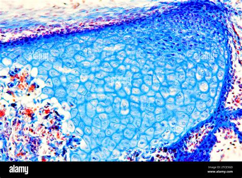 Elastic Cartilaginous Tissue From The Ear Showing Chondrocytes Elastin Fibers And Matrix