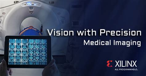 Vision With Precision Medical Imaging A Free Webinar From Xilinx