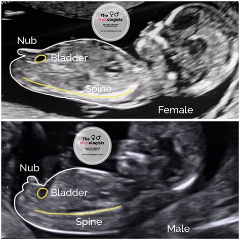 The Nub Theory Explained The Nubologists