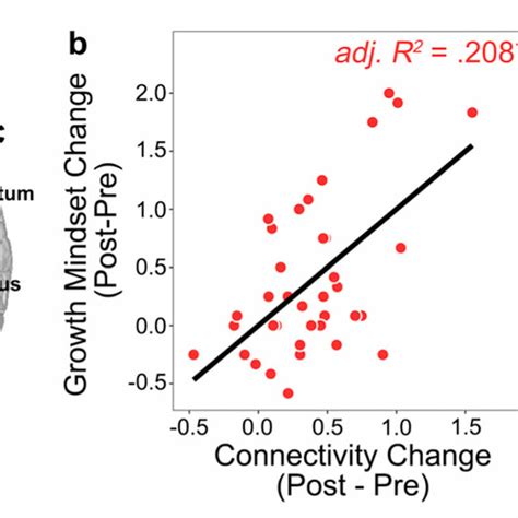 Plasticity Of Dorsal Acc Subcortical Functional Connectivity Associated