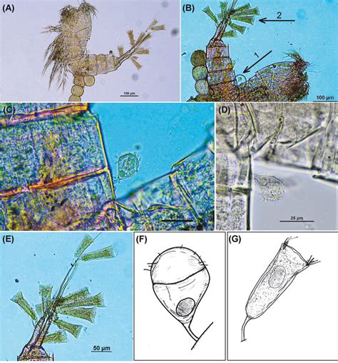 A Host Harpacticoid Copepod Complete View With Ciliate Infestation