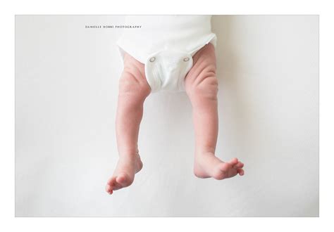 Newborn Kneecap