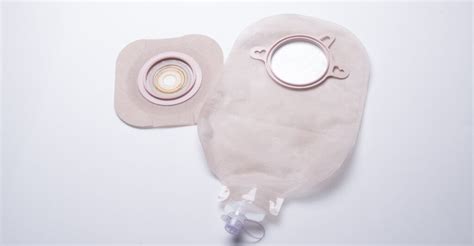 Ileal Conduit Care And Nurses A Review Of Evidence Based Practice Wcei