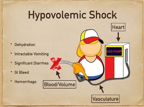 Atrial Flutter Artofit