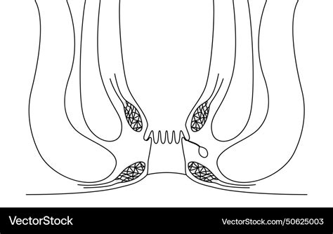 Human Body Rectum And Anus Area Cross Sectional Royalty Free Vector