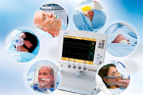 The Servo Ventilator Story