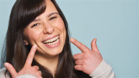 Lightforce Braces Best 3d Printed Braces In Vancouver