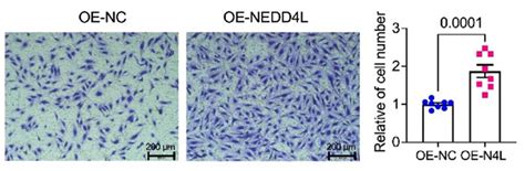 细胞功能实验那些事∣细胞迁移和侵袭（3）之transwell实验 哔哩哔哩
