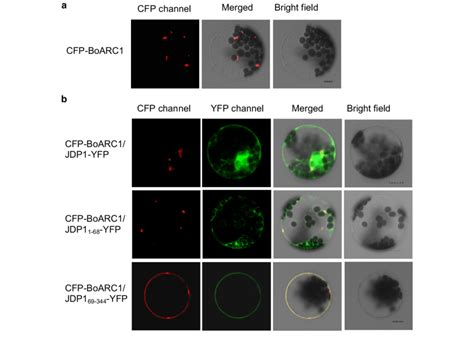 Subcellular Colocalization Of Jdp1 Yfp Jdp1 1 68 Yfp Or Jdp1 69 344 Download Scientific