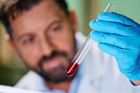 Understanding The Link Between Testosterone And Cholesterol What You