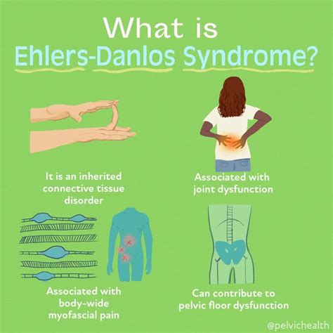 Ehlers Danlos Syndrome Type 5