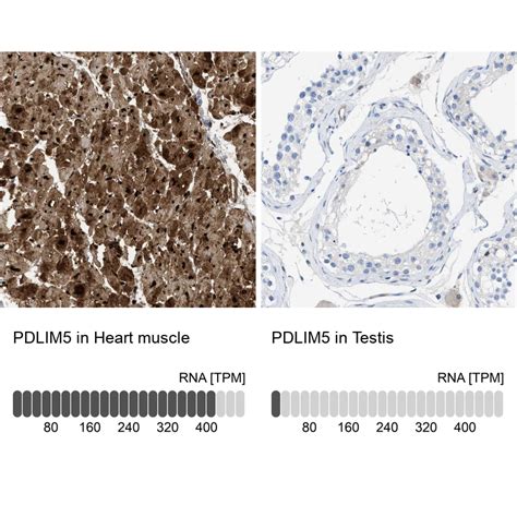 Rabbit Polyclonal Anti Pdlim5 Antibody Buy For Research Highly