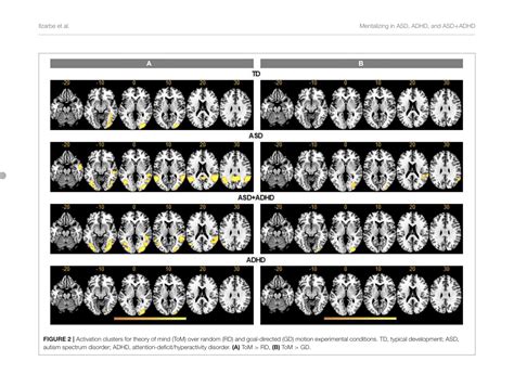 First Visual Fmri Now Shows Tom In Asd And Adhd Addspeaker