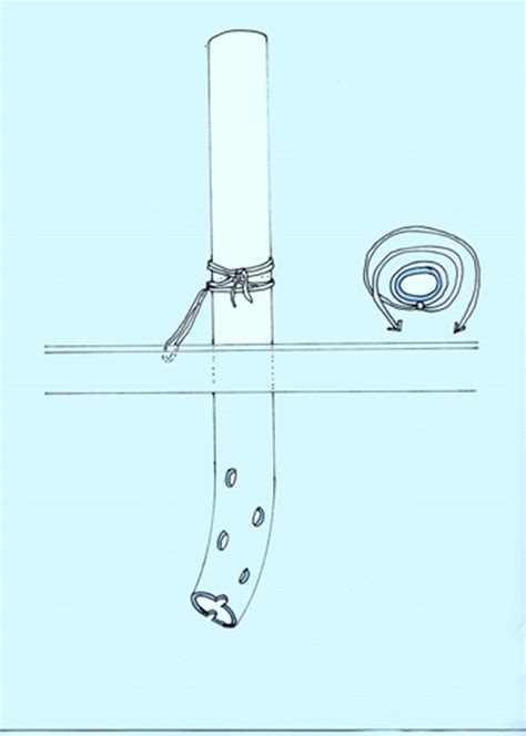 A New Adaptation For A Secure Surgical Drain Placement And A Comparison