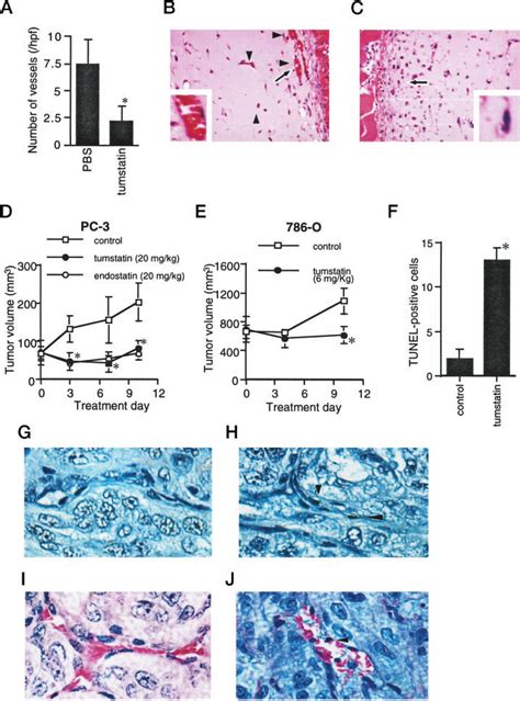 Matrigel Plug Assay And In Vivo Tumor Studies Sections Of Each