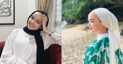 Dahi Luas Beautifulnara Terkini Dan Sensasi