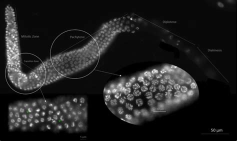 Spatial And Temporal Development Of The Germline In Hermaphrodite C
