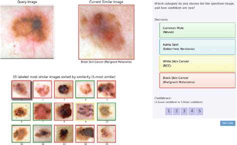 Sample Screenshot With Cbir Algorithm Results Download Scientific