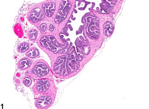 Where Are The Seminal Vesicles
