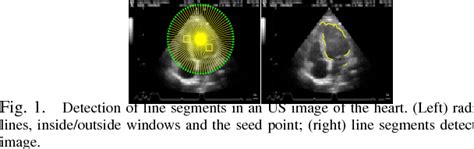 Figure 2 From Improved Gradient Vector Flow For Robust Shape Estimation In Medical Imaging