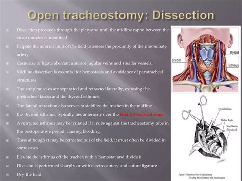 Tracheostomy Final Pptx Ear Nose And Throat Conditions Diseases