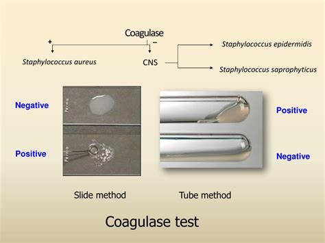 Ppt Isolation And Identification Of Staphylococci Powerpoint Presentation Id3098162