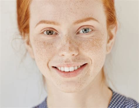 What Is Heterochromia Blog Eyebuydirect