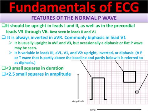 P Wave Abnormalities In Ecg Ppsx