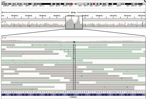 Visualisation Dun Fichier Bam Avec Le Logiciel Igv Integrative Genome