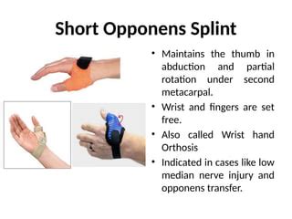 Upper Limb Orthotic Orthotics Describing About The Splints Pptx
