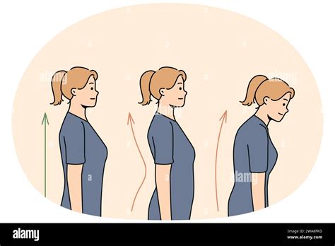 Set Of Young Woman Posture Correction Collection Of Female With And Without Back Problems