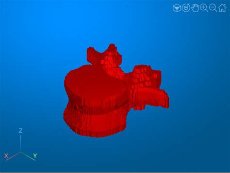 Medical Image Based Finite Element Analysis Of Spine Matlab And Simulink