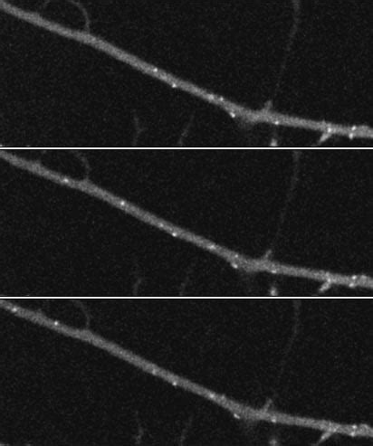 Time Lapse Recording Of An Axon Of An Infected Drg Sensory Neuron A
