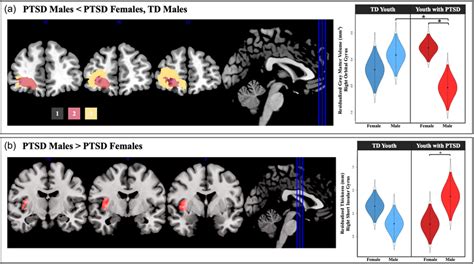 Sexbased Variations In Brain Structure Among Youth With Posttraumatic Download Scientific