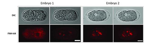 19 Still Images From Upright Spinning Disk Microscopy Films Of Two Download Scientific Diagram