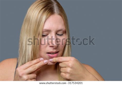 Woman Squeezing Pimple Spot Zit Blackhead Stock Photo 317534201 Shutterstock