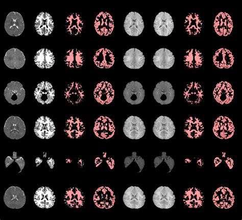 Samples Of Brain Structure Segmentation Results On Iseg2017 A E
